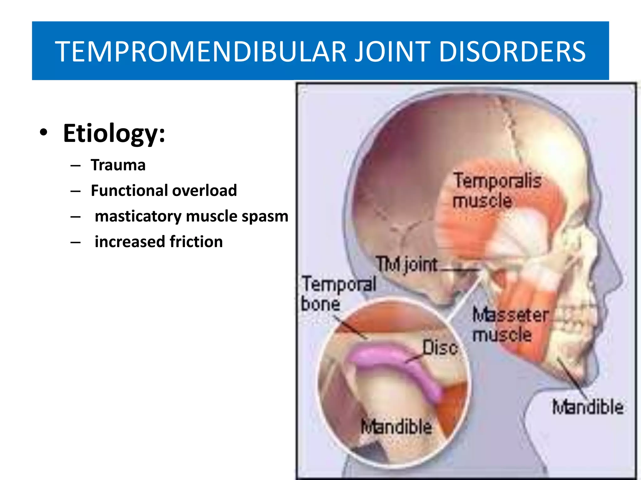 Tmj disorders | PPTX