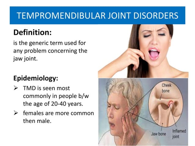 Tmj Disorders Ppt