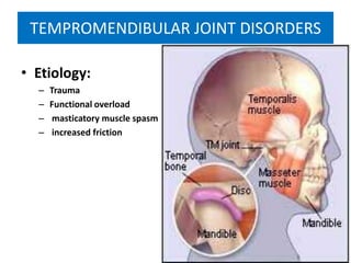Tmj disorders | PPTX