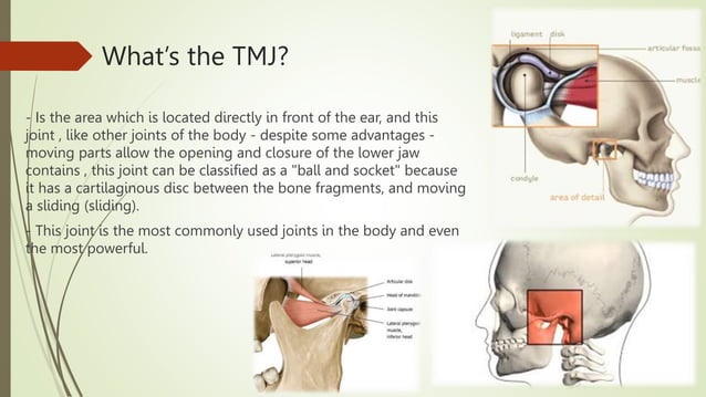 TMJ_disorders_pptx tariq faridi edition.pptx