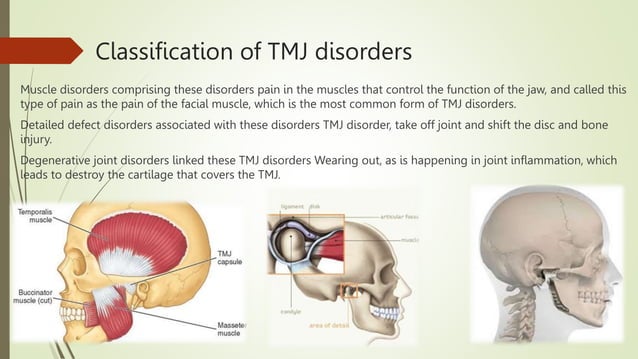 TMJ_disorders_pptx tariq faridi edition.pptx