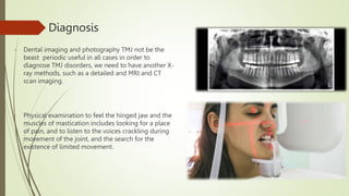 TMJ_disorders_pptx tariq faridi edition.pptx