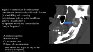 TEMPORO MANDIBULAR JOINT IMAGING PPT | PPTX