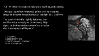 TEMPORO MANDIBULAR JOINT IMAGING PPT | PPTX