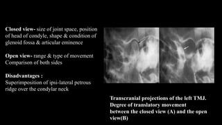 TEMPORO MANDIBULAR JOINT IMAGING PPT | PPTX