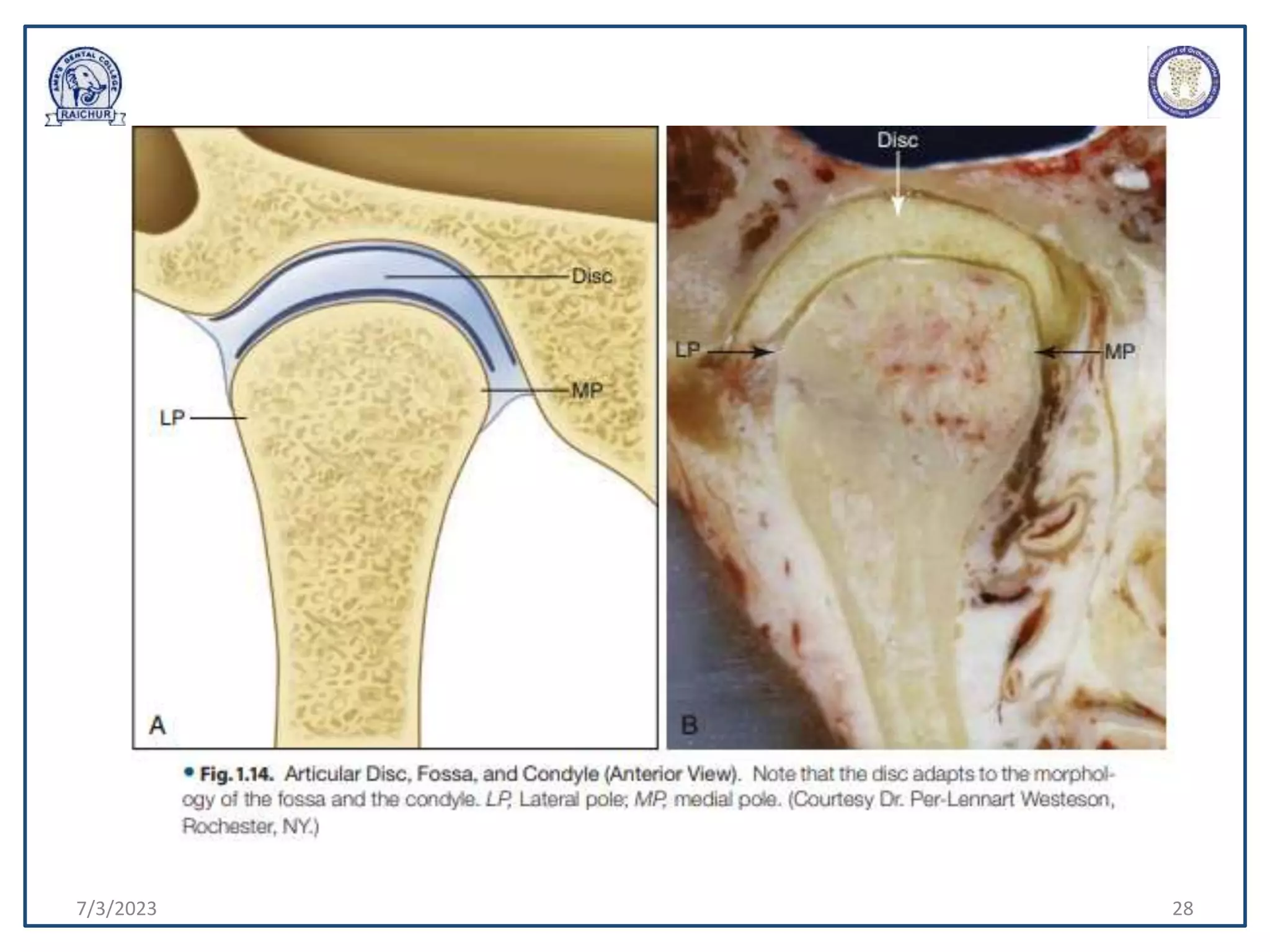 TMJ EVALUATION AND ITS ANATOMY.pptx