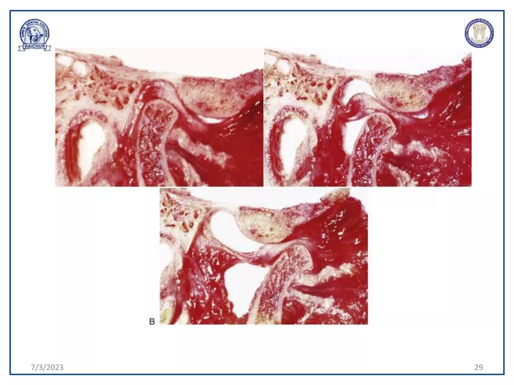 TMJ EVALUATION AND ITS ANATOMY.pptx