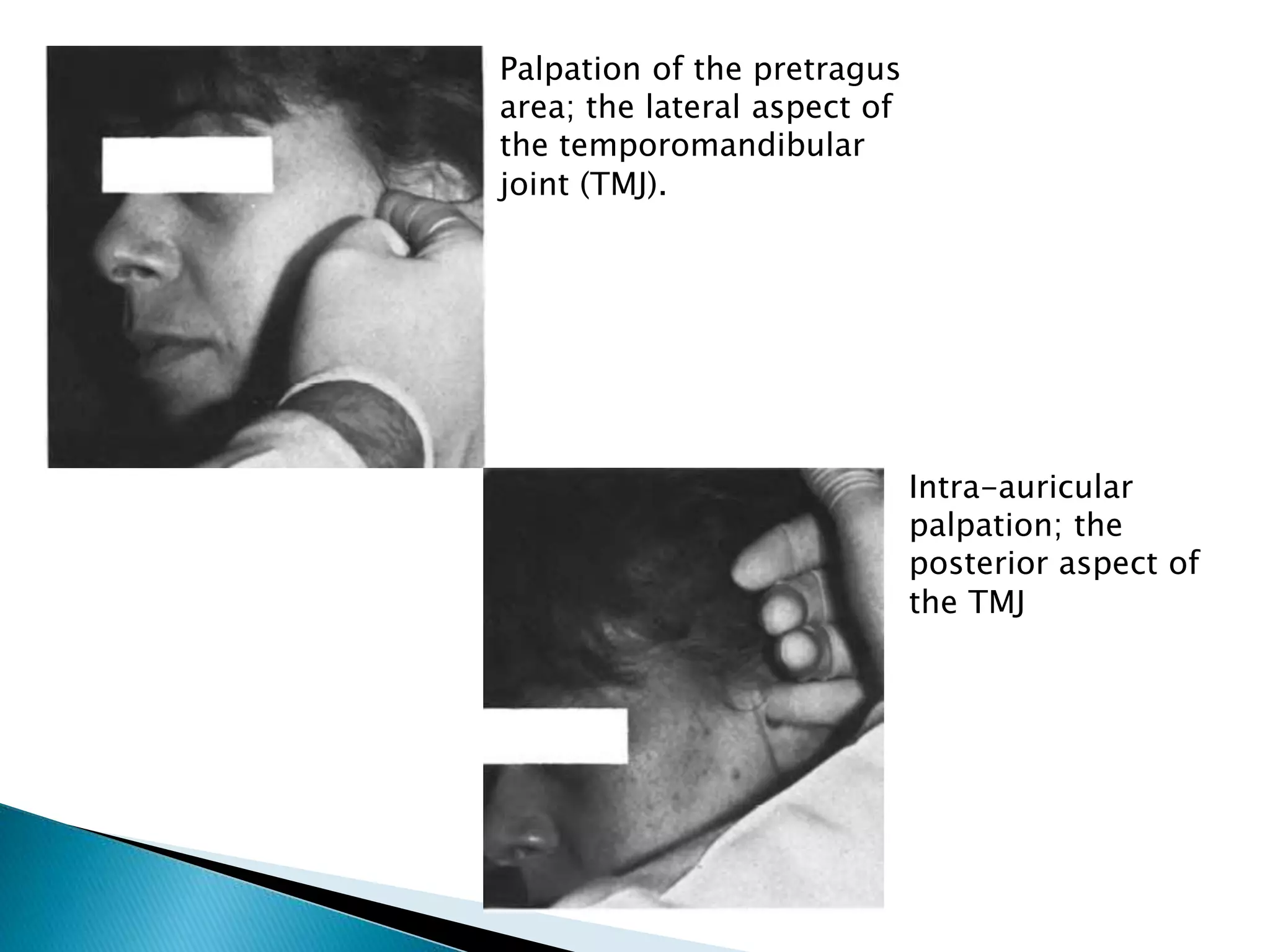 Tm j examination | PPTX