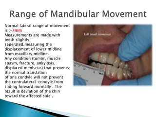 Tm j examination | PPTX