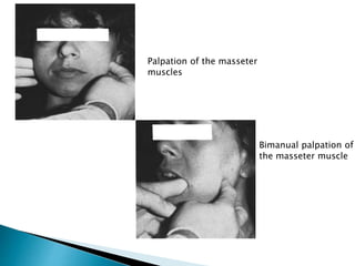 Tm j examination | PPTX