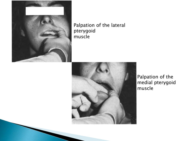 Tm j examination | PPTX | Bone and Joint Conditions | Diseases and ...