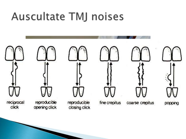 Tm j examination | PPTX | Bone and Joint Conditions | Diseases and ...