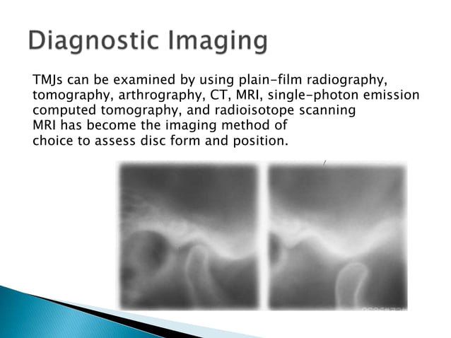 Tm j examination | PPTX | Bone and Joint Conditions | Diseases and ...