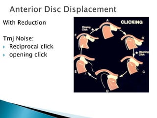 Tm j examination | PPTX