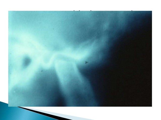 Tm j examination | PPTX | Bone and Joint Conditions | Diseases and ...