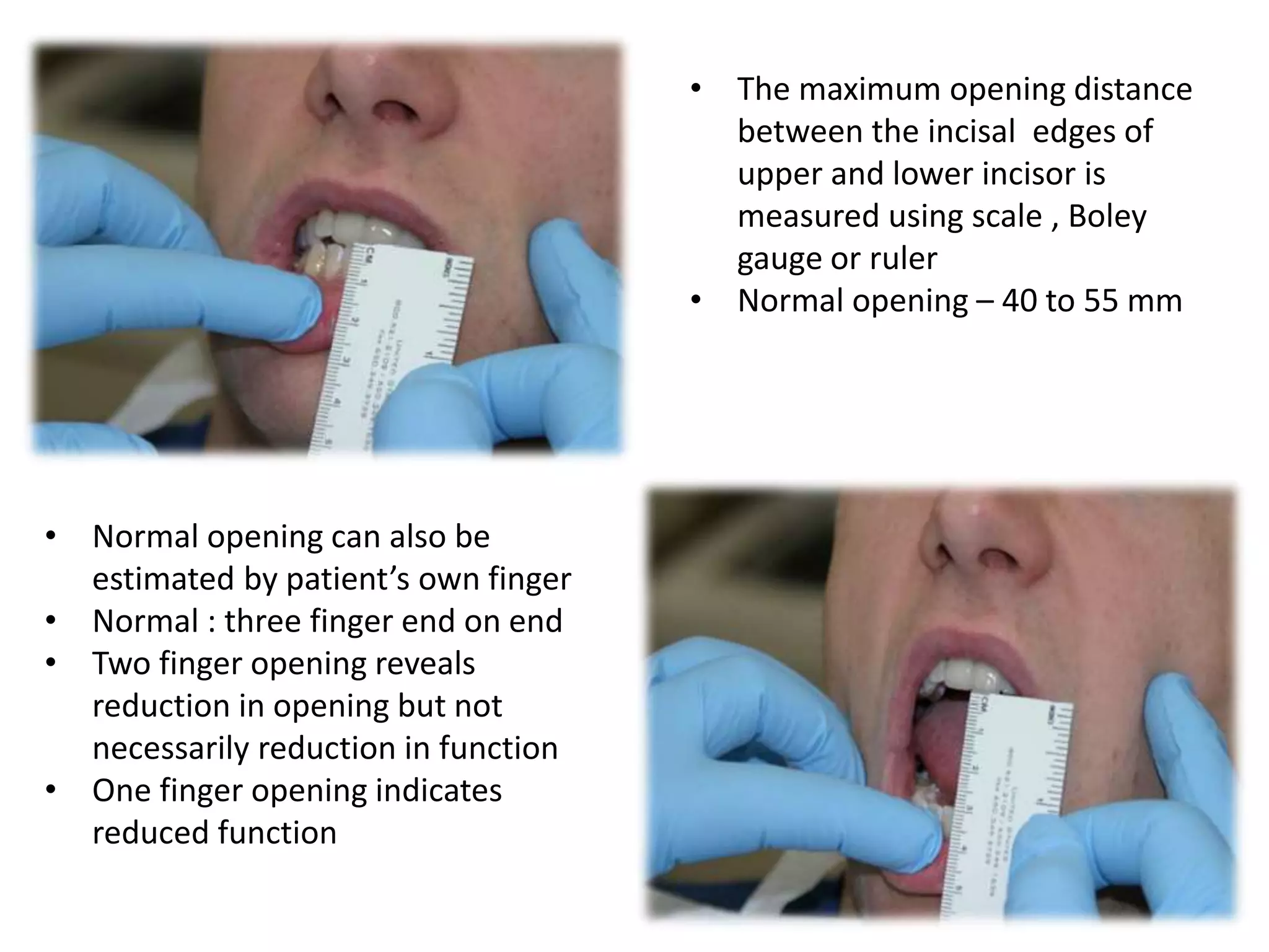 Tmj examination & imaging | PPTX