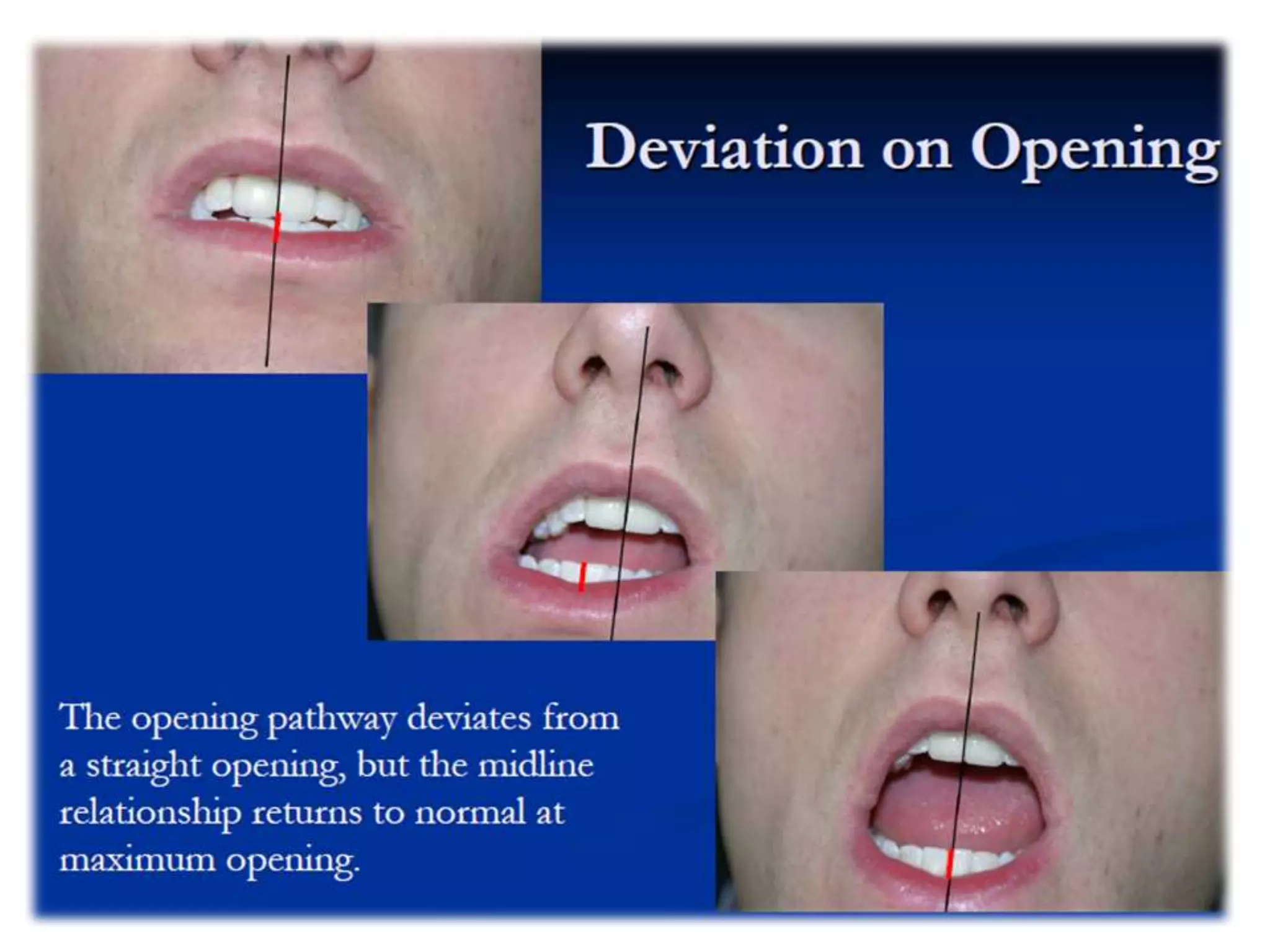 Tmj examination & imaging | PPTX