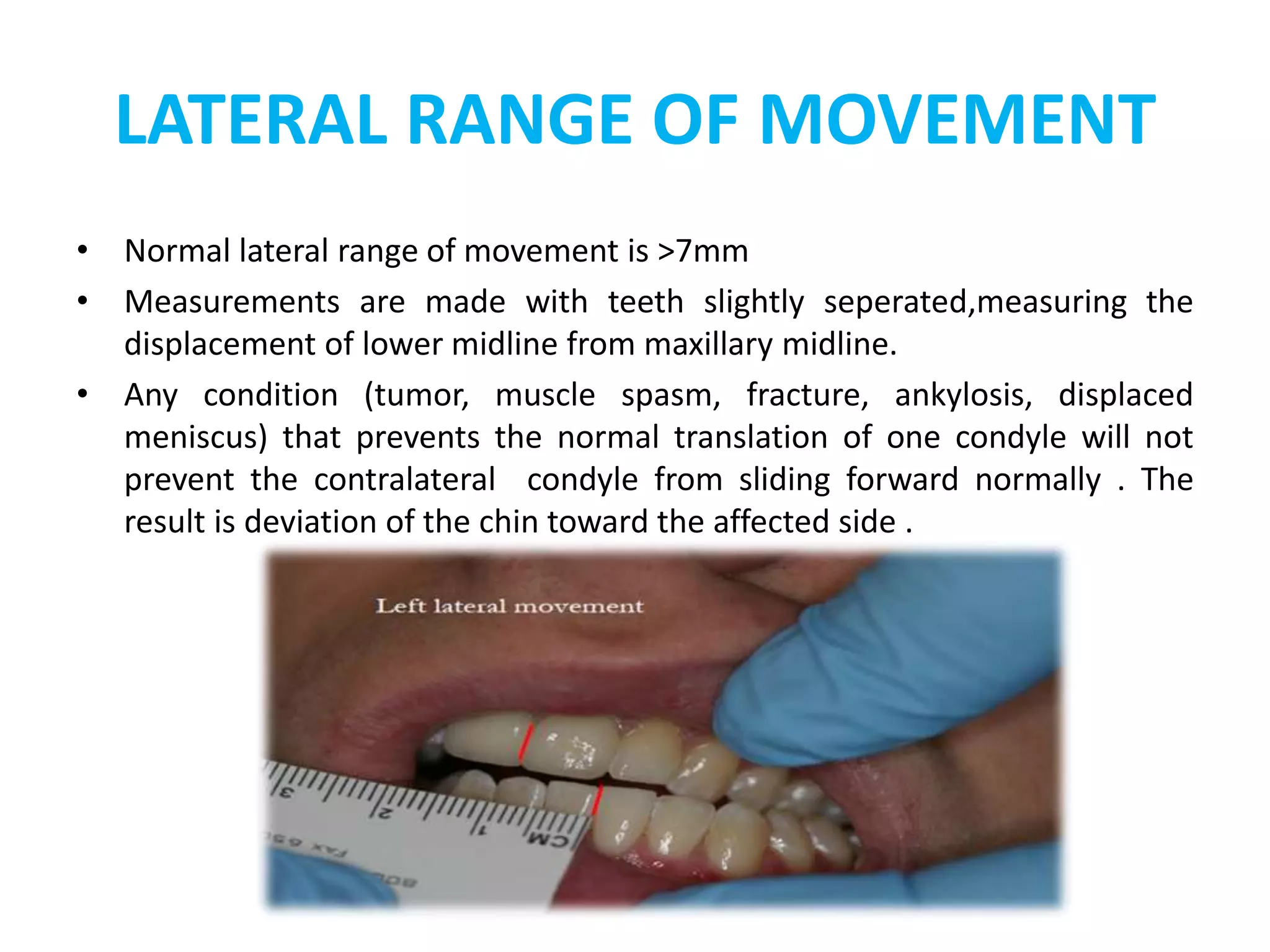 Tmj examination & imaging | PPTX
