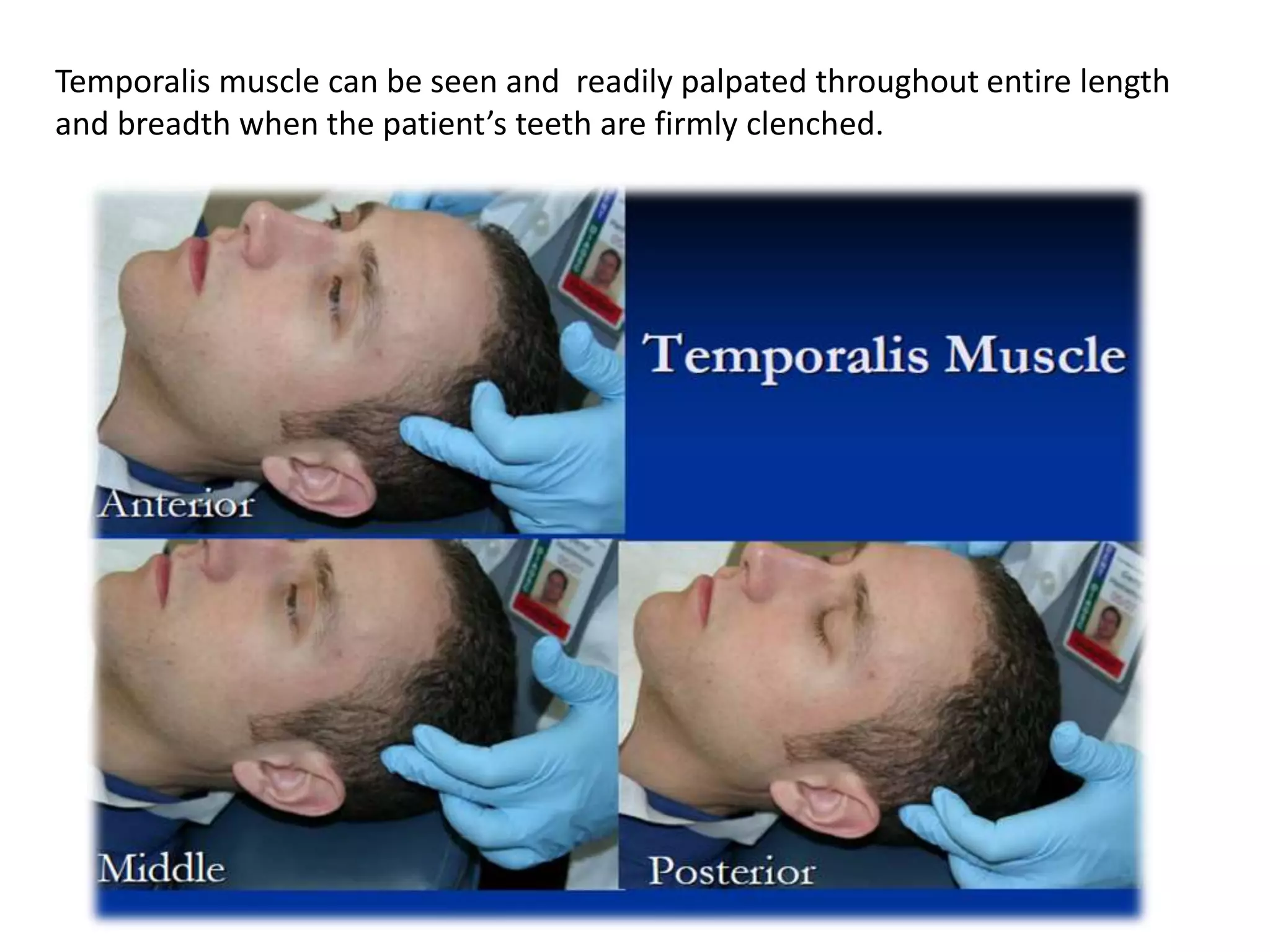 Tmj examination & imaging | PPTX