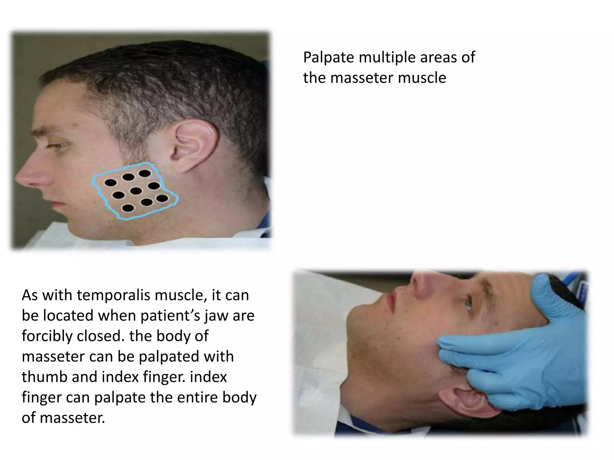 Tmj examination & imaging | PPTX