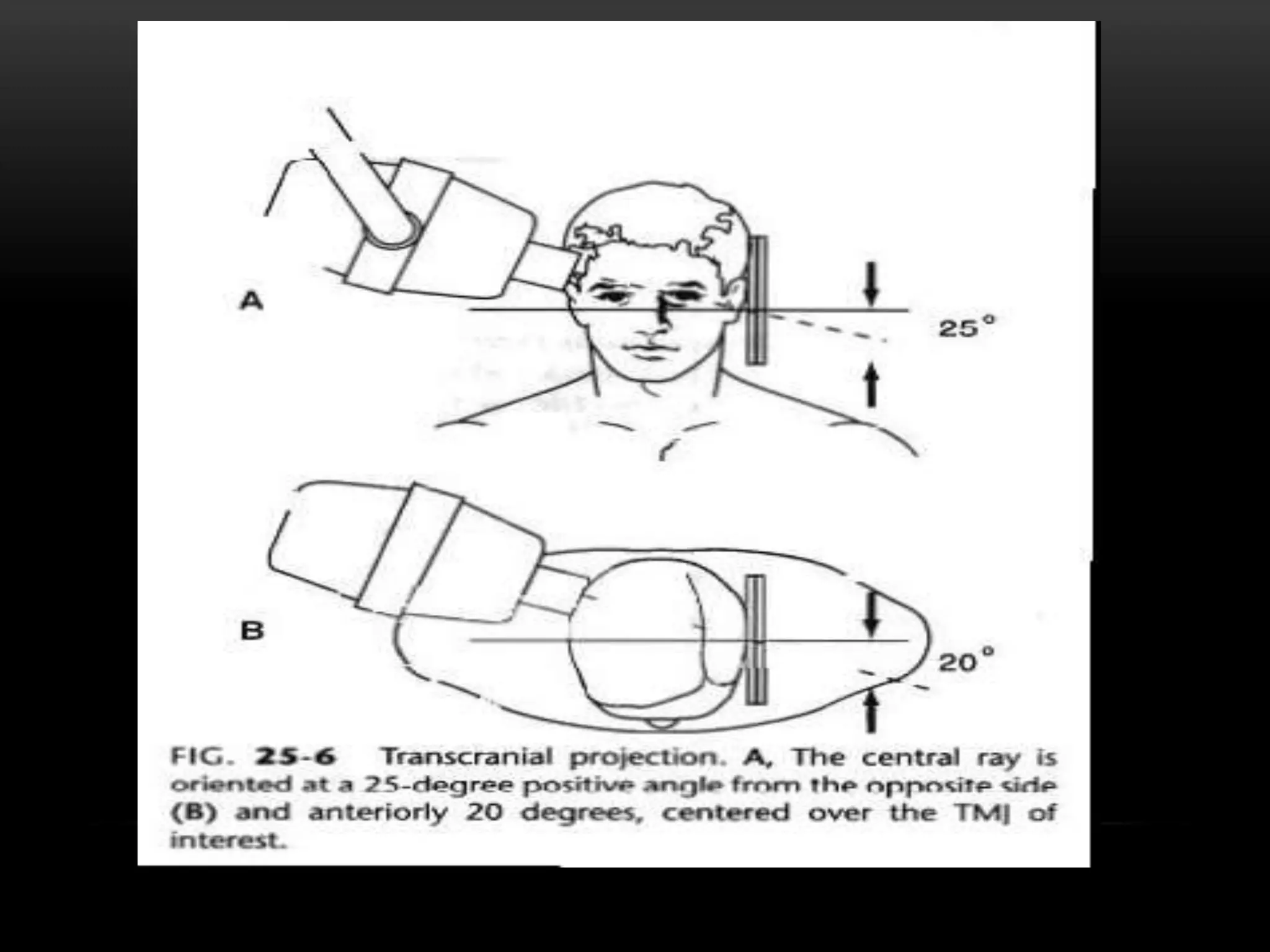 Tmj examination & imaging | PPTX