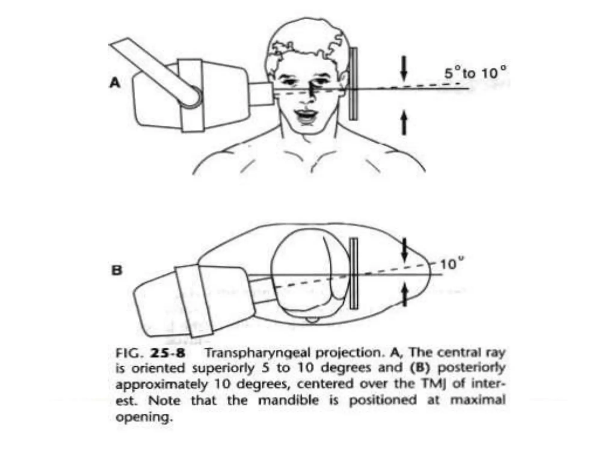 Tmj examination & imaging | PPTX