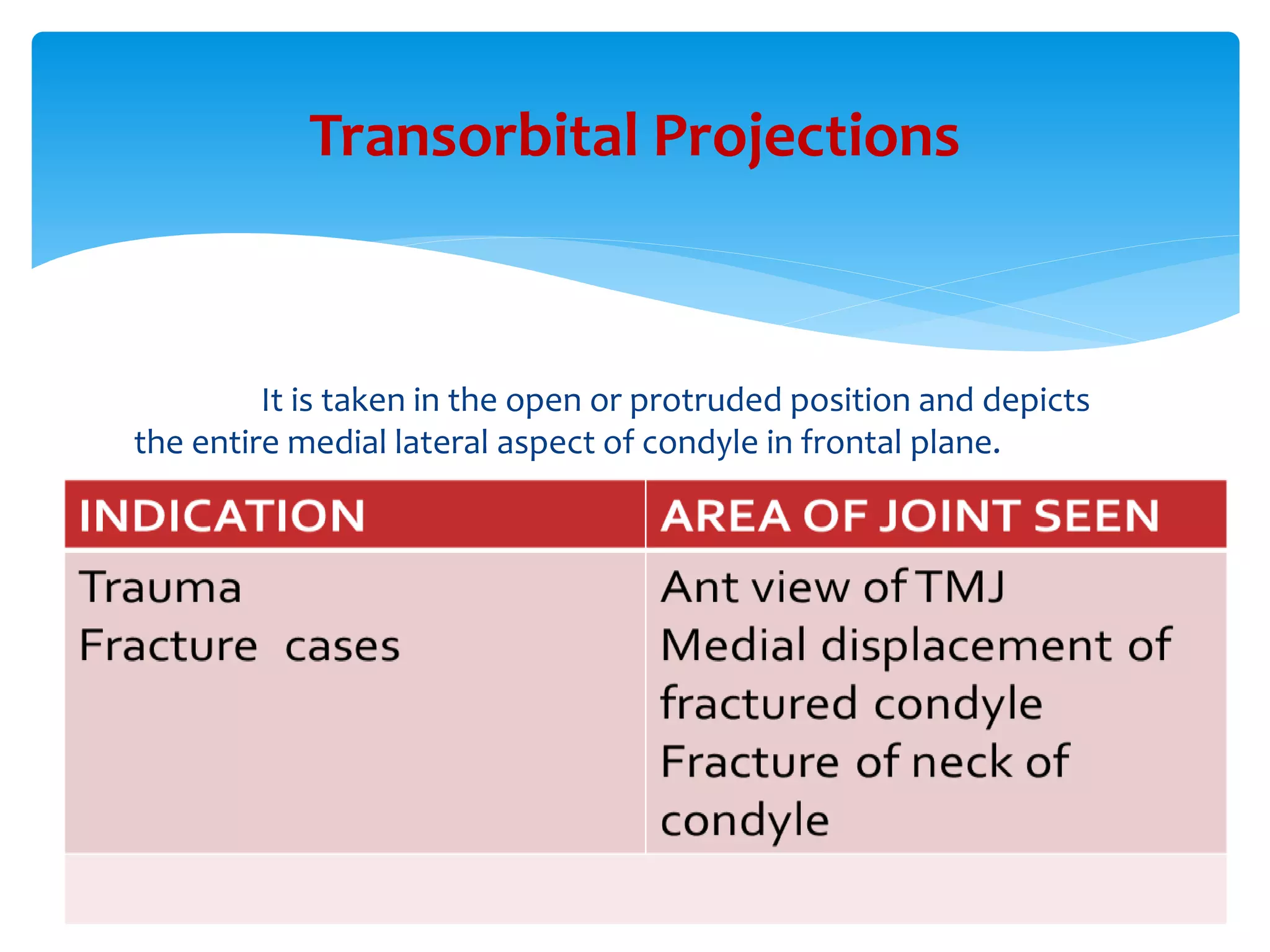 Tmj examination & imaging | PPTX
