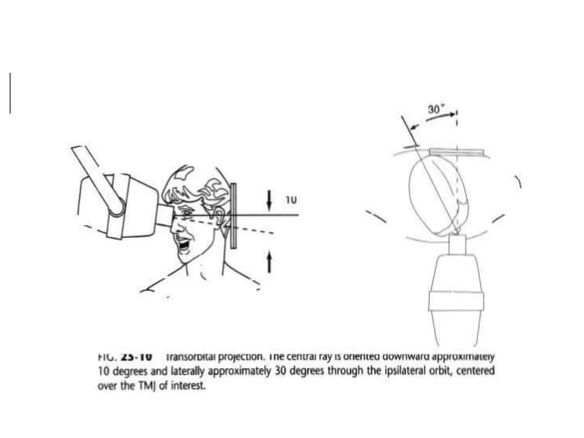 Tmj examination & imaging | PPTX