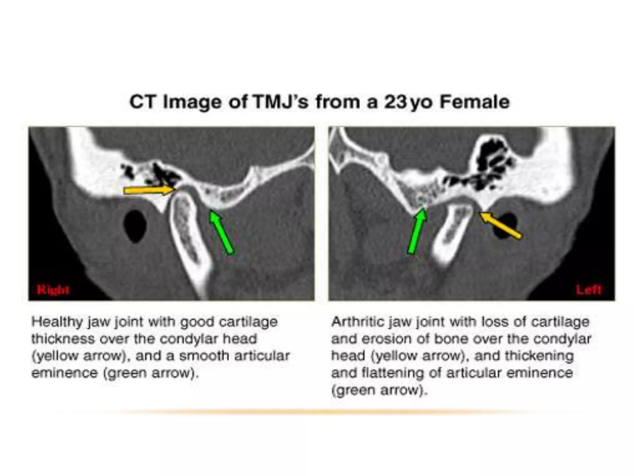 Tmj examination & imaging | PPTX