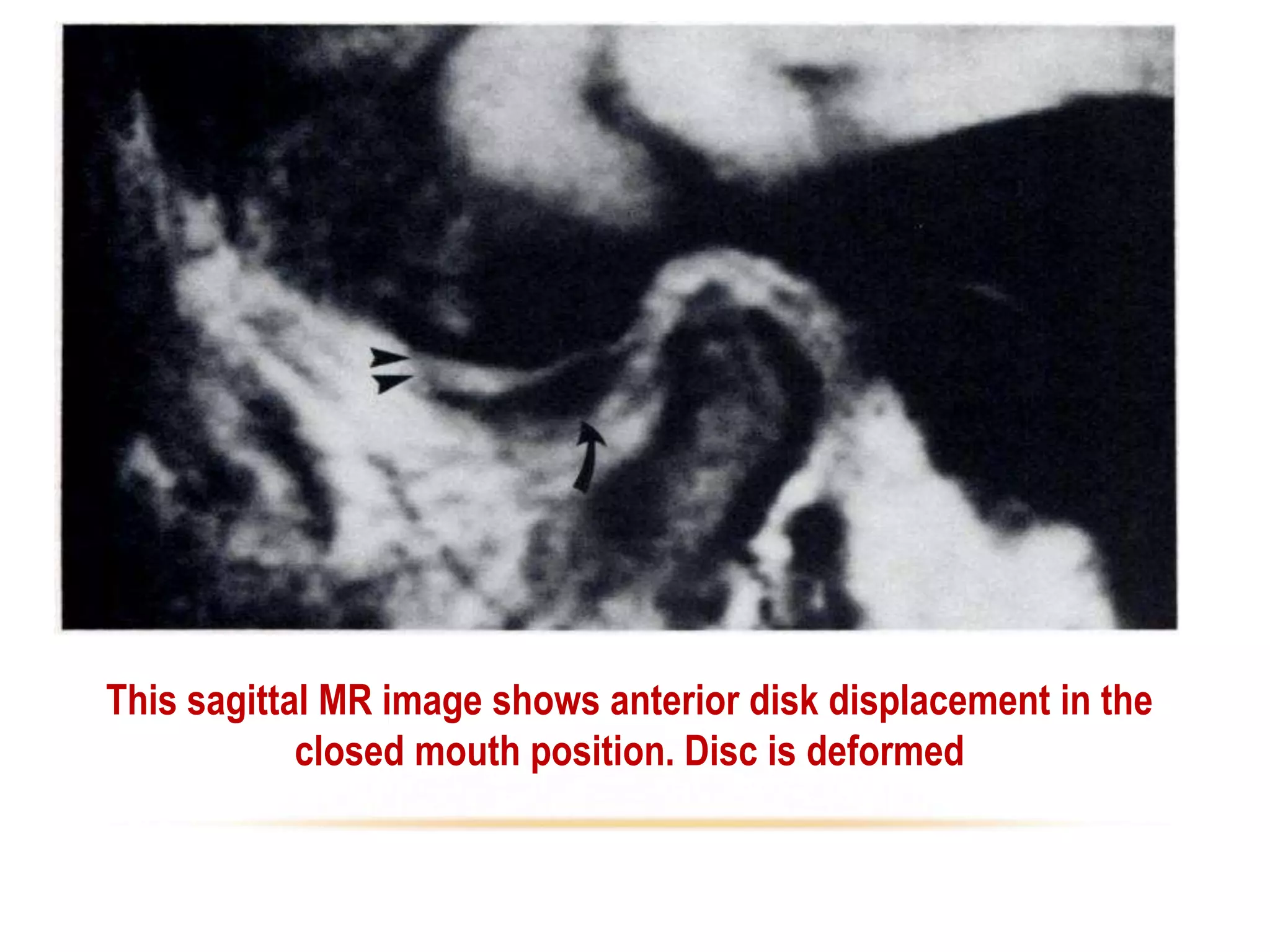 Tmj examination & imaging | PPTX