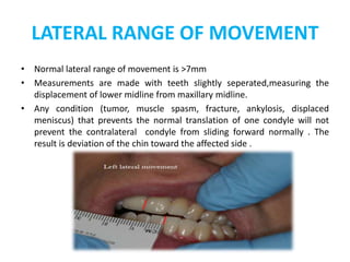 Tmj examination & imaging | PPTX