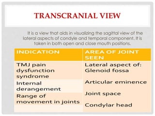 Tmj examination & imaging | PPTX