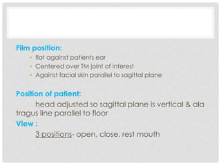 Tmj examination & imaging | PPTX