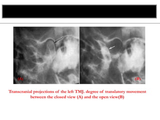Tmj examination & imaging | PPTX