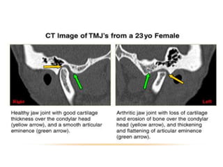 Tmj examination & imaging | PPTX