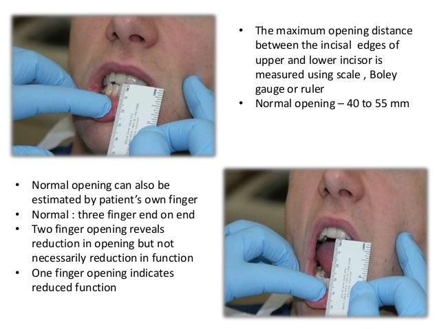 Tmj examination & imaging