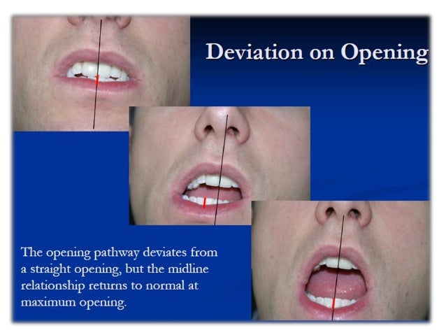 Tmj examination & imaging