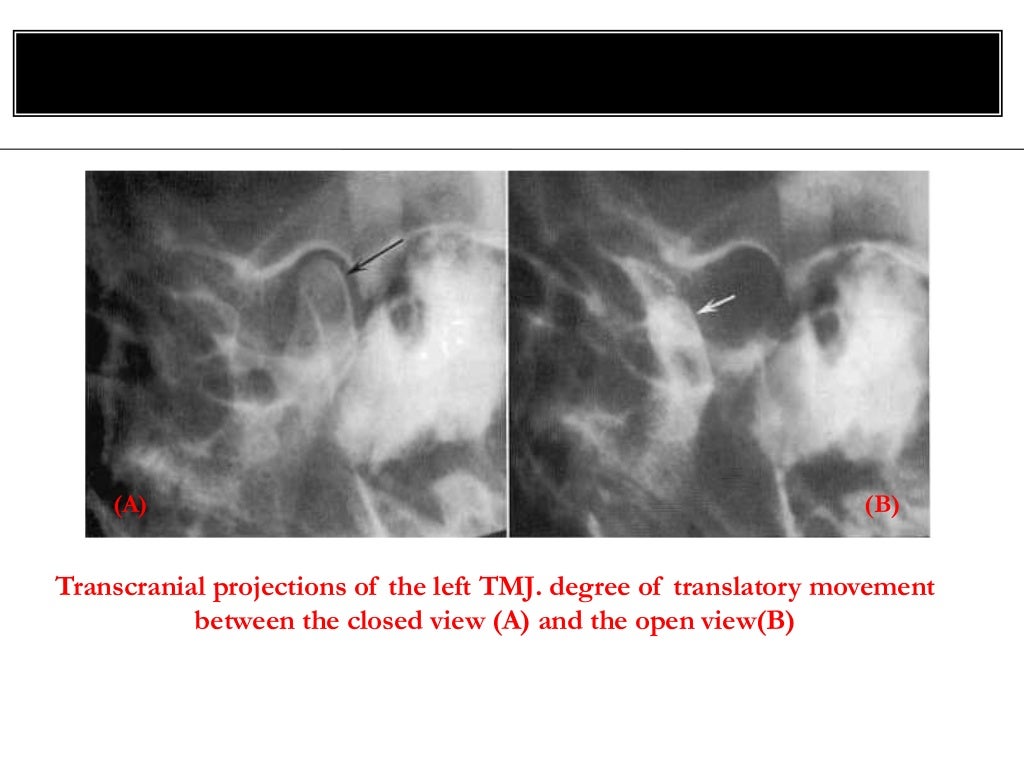 Tmj examination & imaging