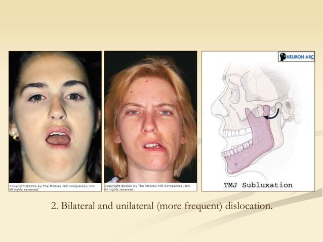 tmj_facialexpr_em1_kom2018.ppt