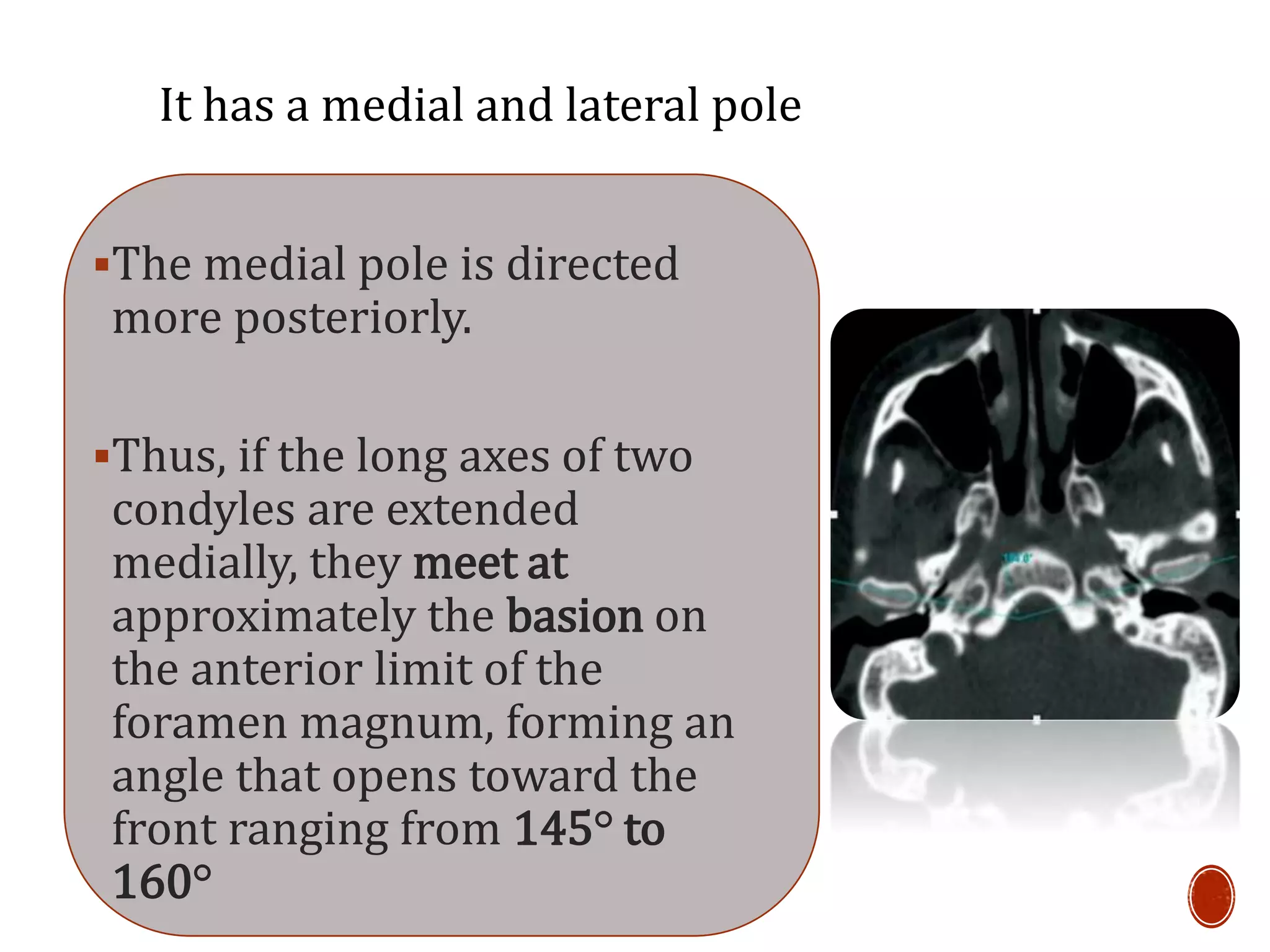 Tmj surgical anatomy and approaches | PPTX