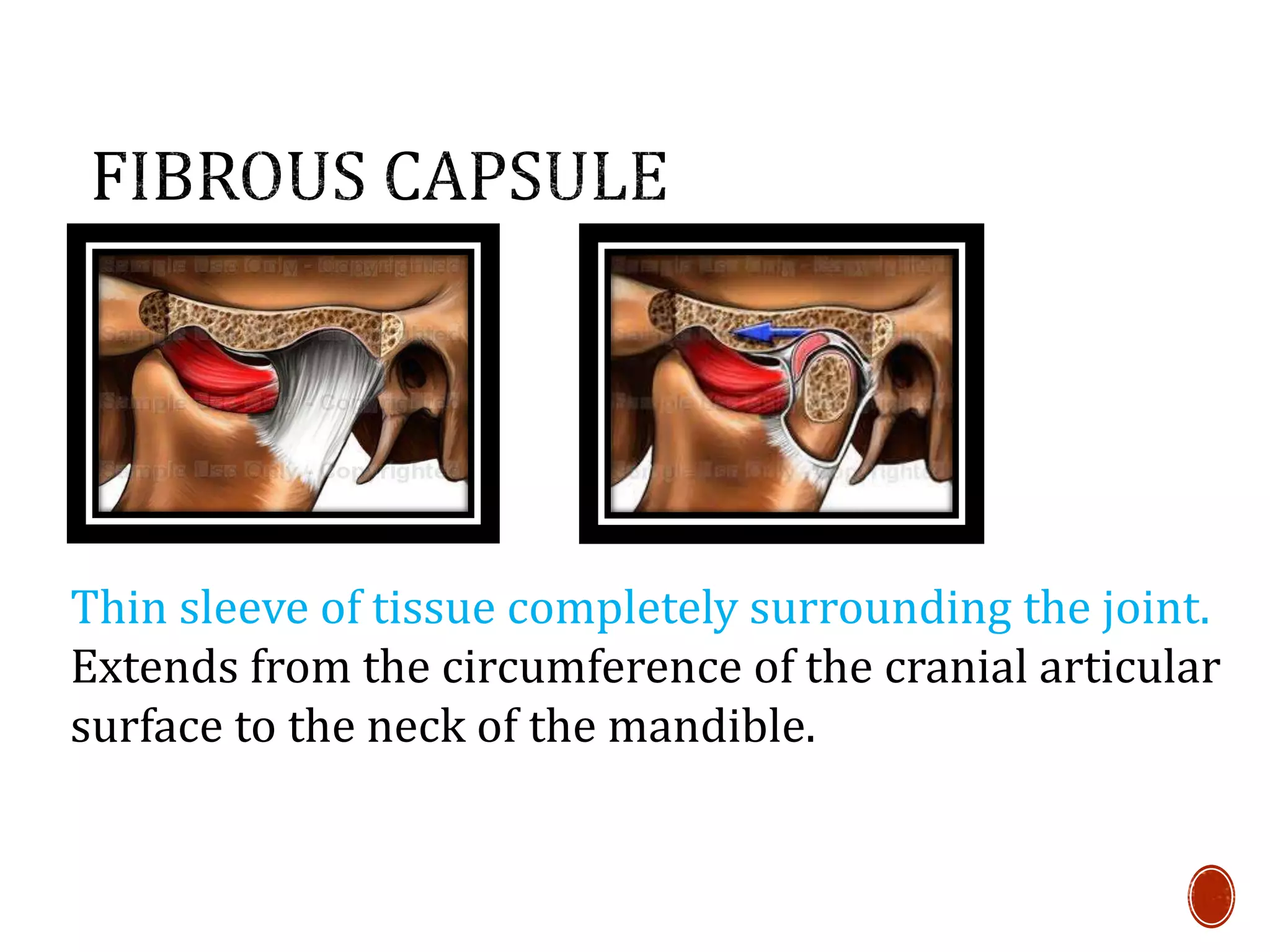 Tmj surgical anatomy and approaches | PPTX