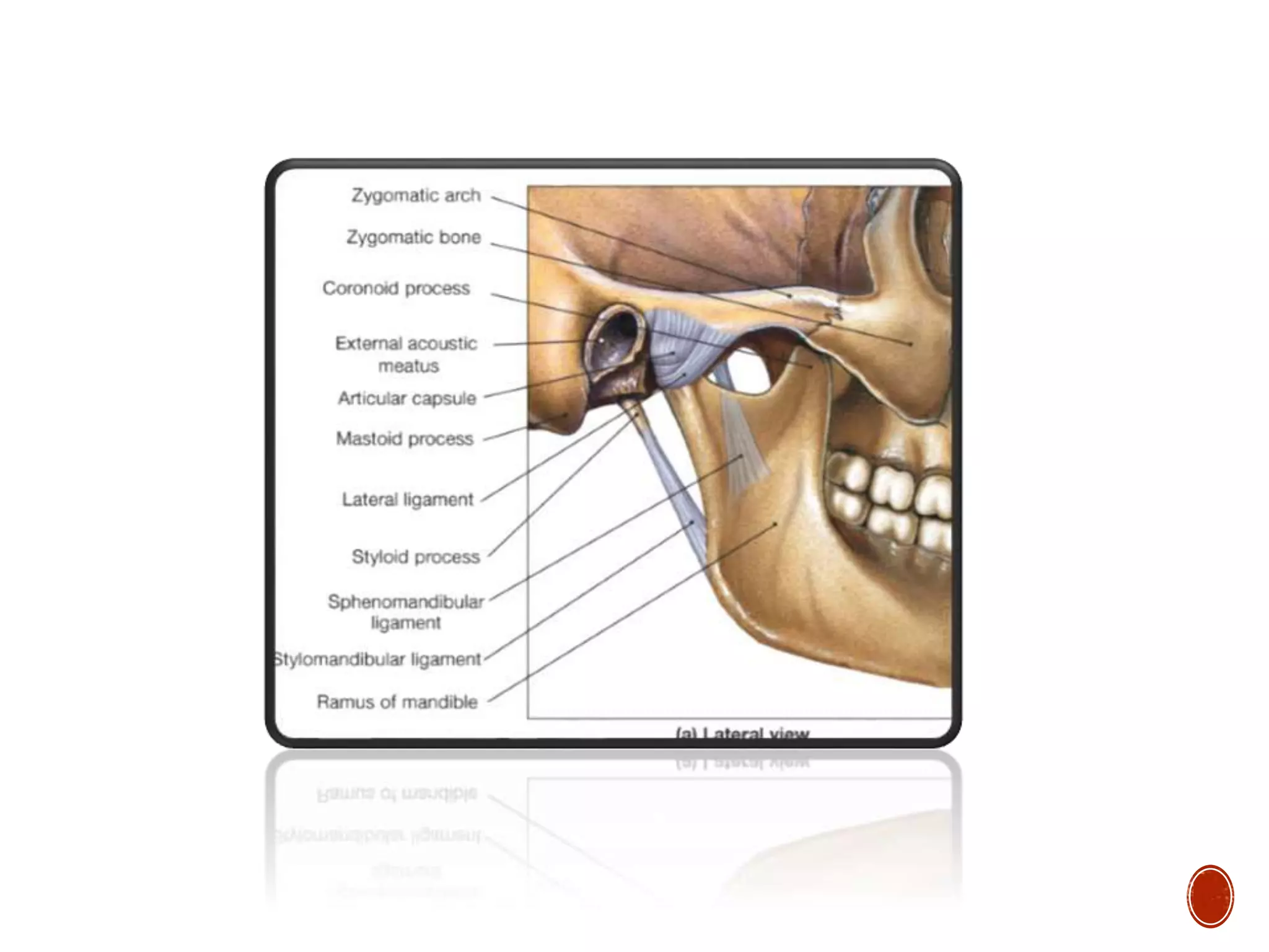 Tmj surgical anatomy and approaches | PPTX