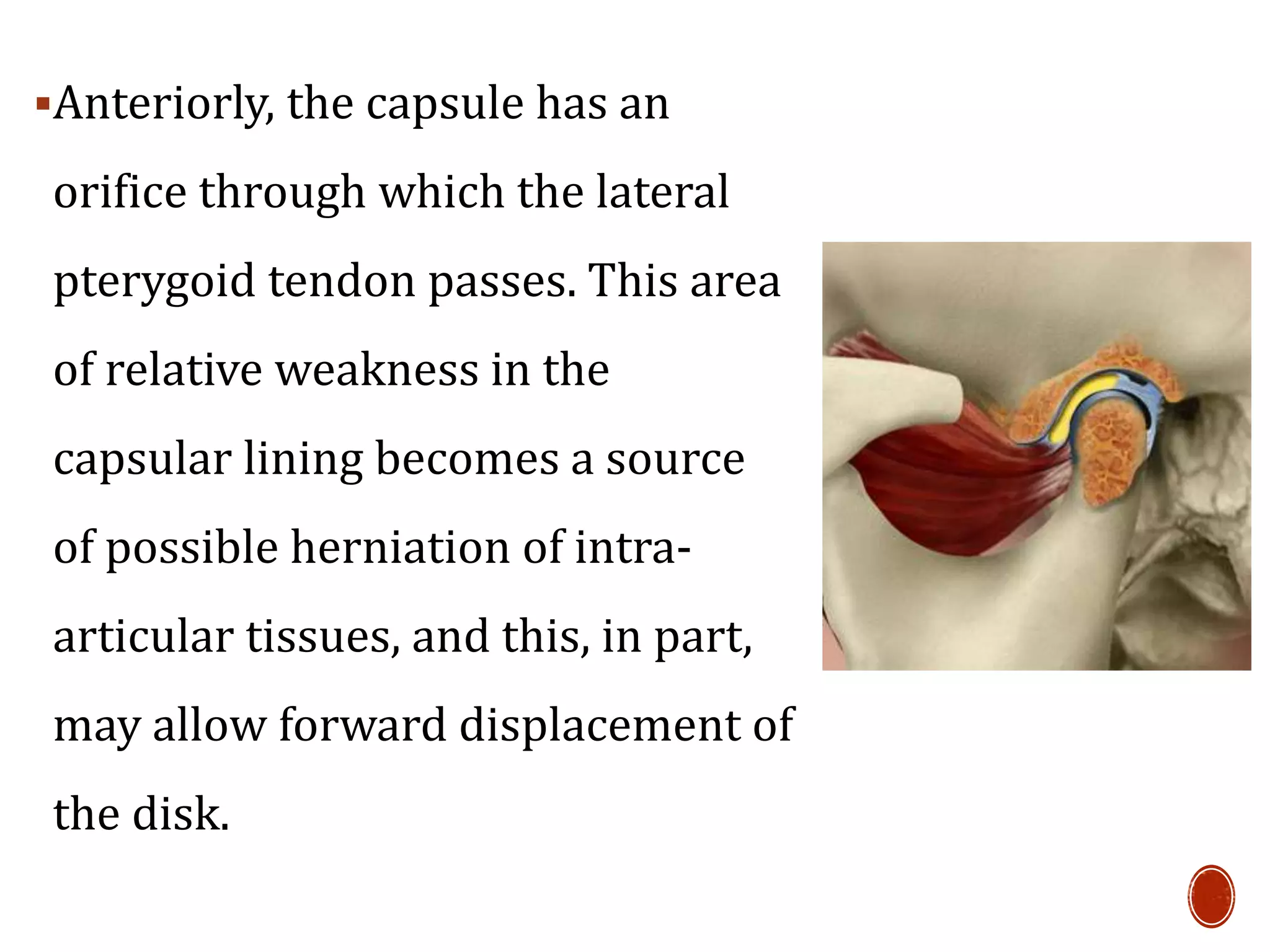 Tmj surgical anatomy and approaches | PPTX