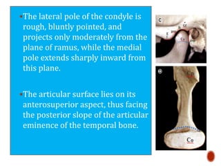 Tmj surgical anatomy and approaches | PPTX