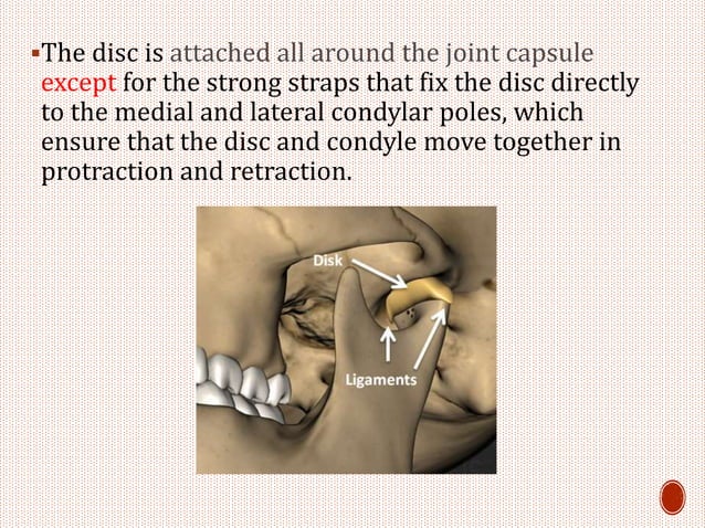 Tmj surgical anatomy and approaches | PPTX