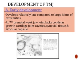 Tmj surgical anatomy and approaches | PPTX
