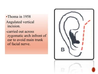 Tmj surgical anatomy and approaches | PPTX