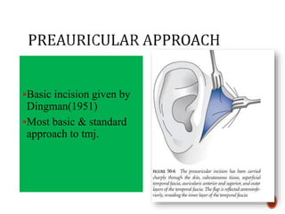 Tmj surgical anatomy and approaches | PPT