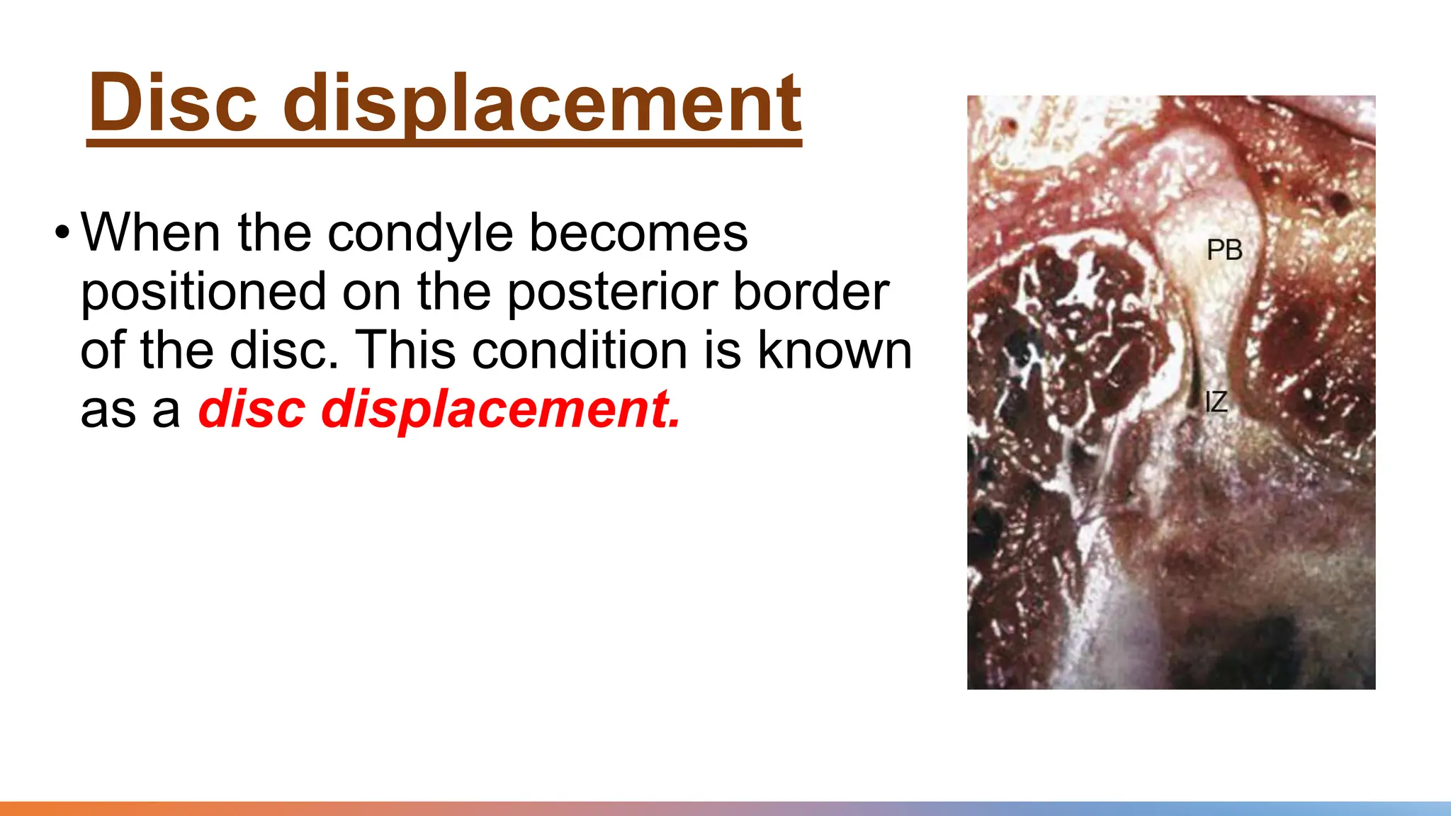 Tmj final.pptx........................... | PPT