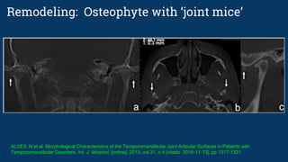 Tmj findings in cbct & mri | PPTX